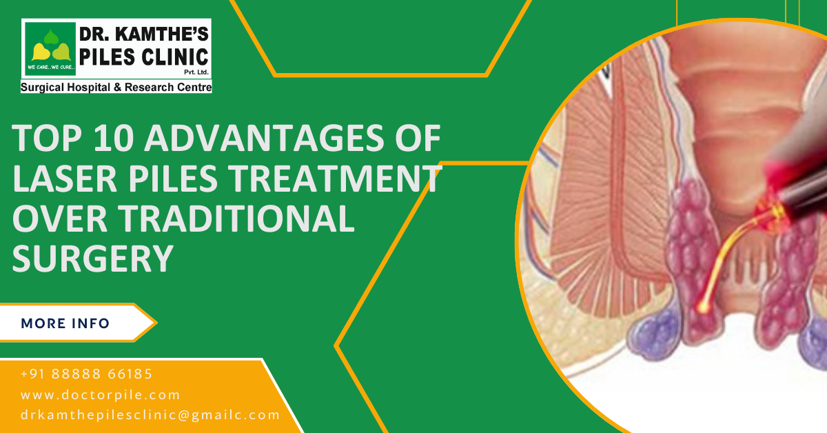 Top 10 Advantages of Laser Piles Treatment Over Traditional Surgery ...